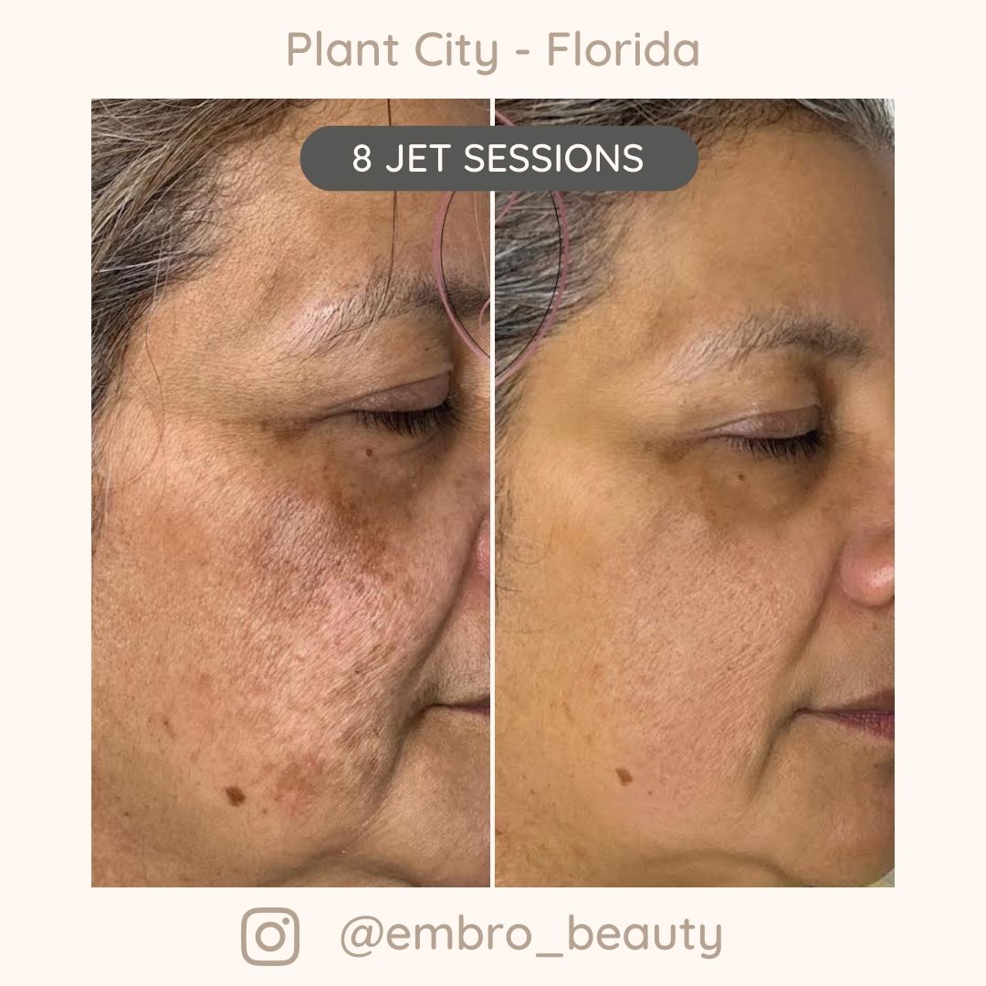 Home - Pro Plasma Esthetic
