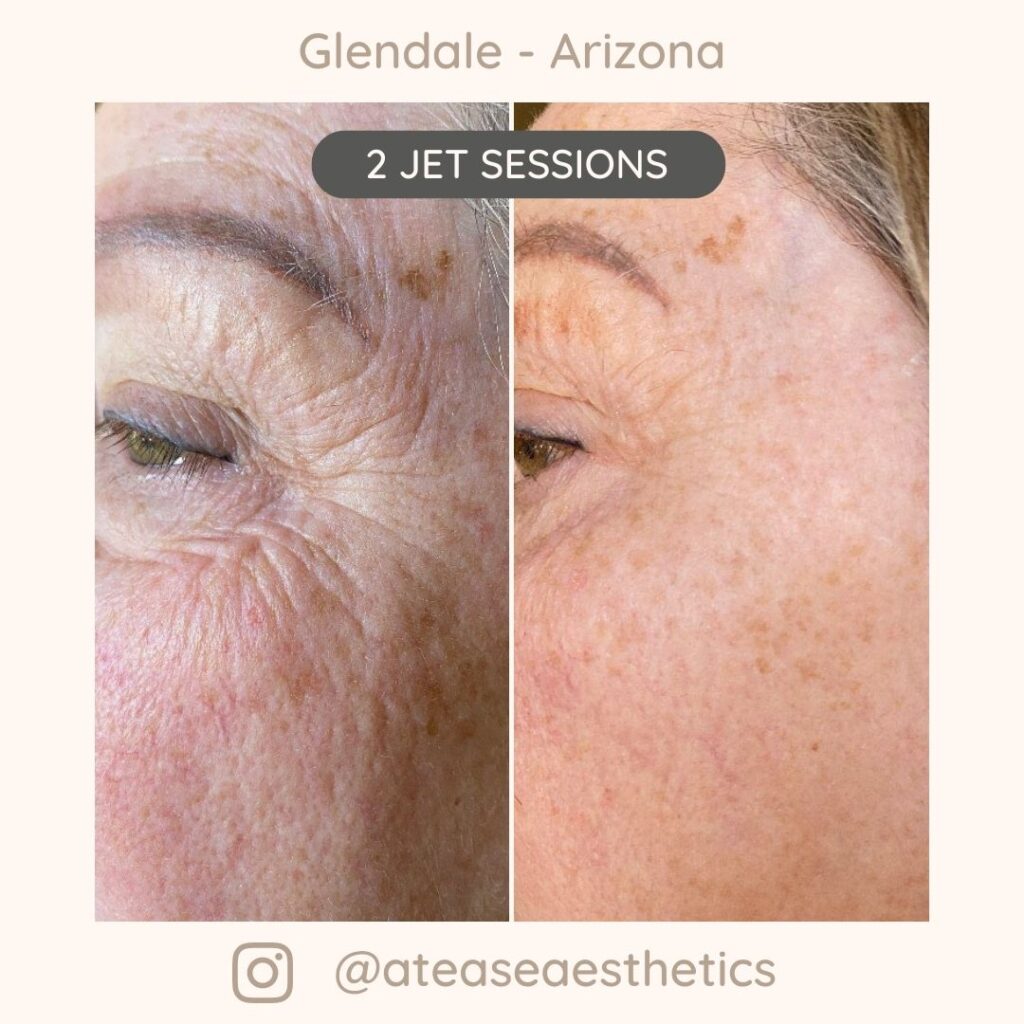 Home - Pro Plasma Esthetic