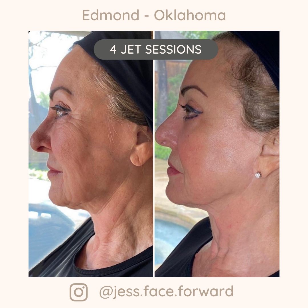 Home - Pro Plasma Esthetic