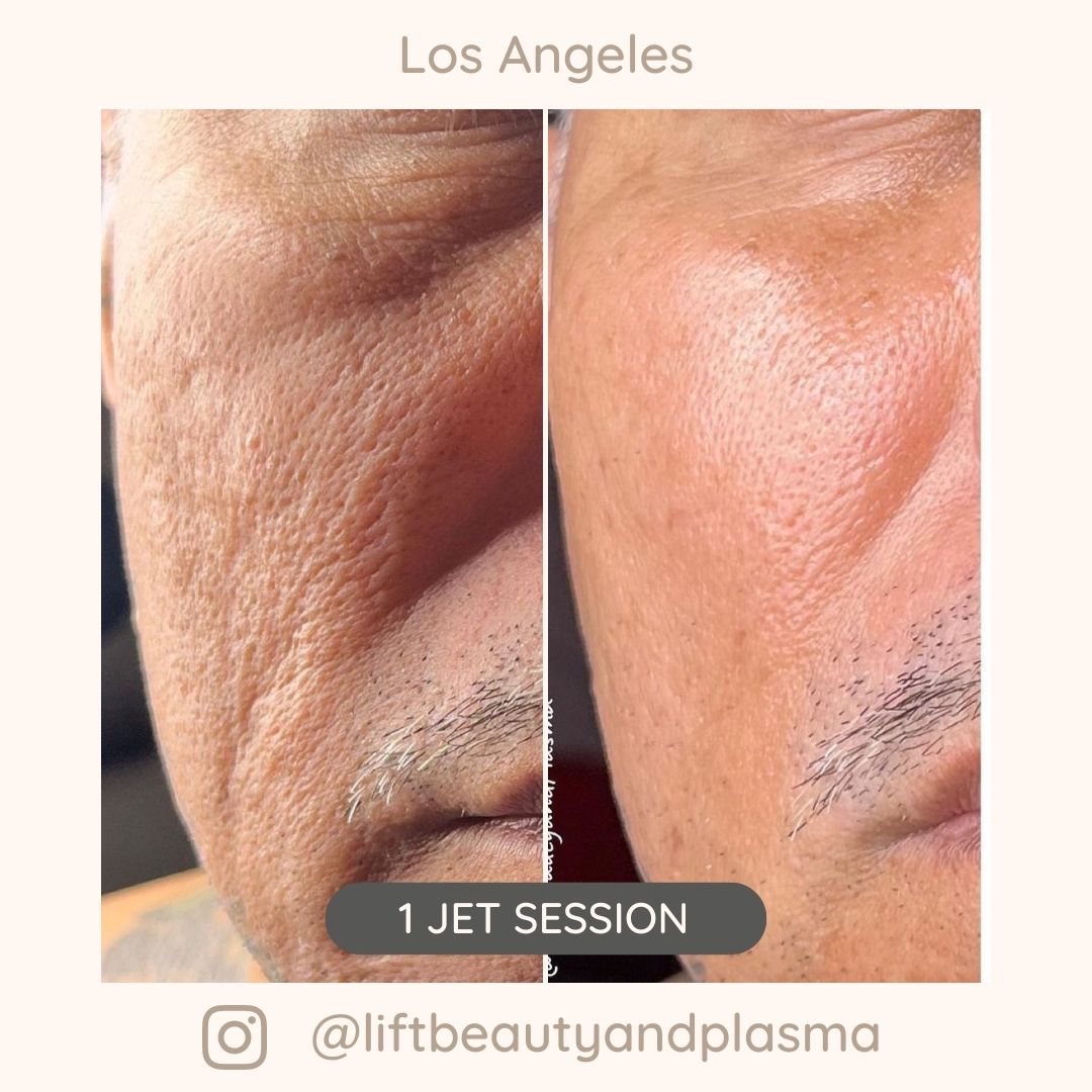 Home - Pro Plasma Esthetic